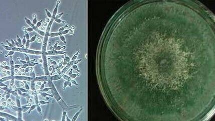 Trichoderma harzianum, agente de control biológico y biofertilizante